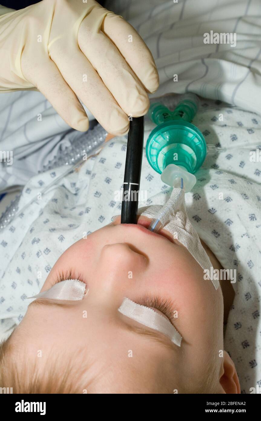 Young boy undergoing endoscopic examination - Model Released Stock ...