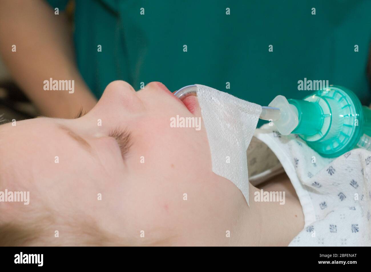 Young child wearing a tracheostomy tube during operation Stock Photo ...
