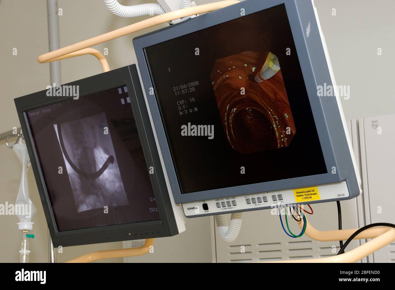 Computer monitor view of an endoscope examination Stock Photo - Alamy