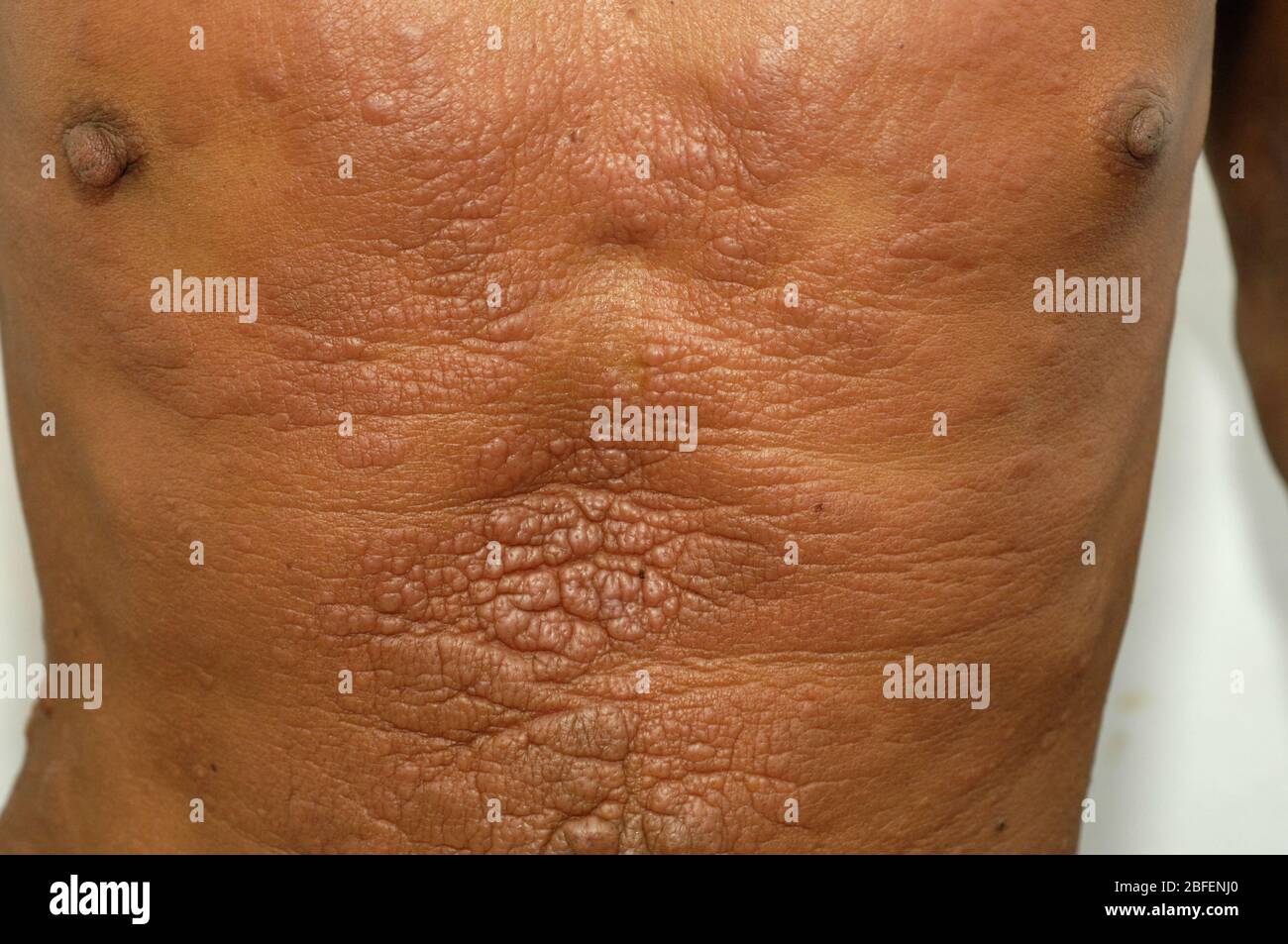 Dorsal root ganglion hi-res stock photography and images - Alamy
