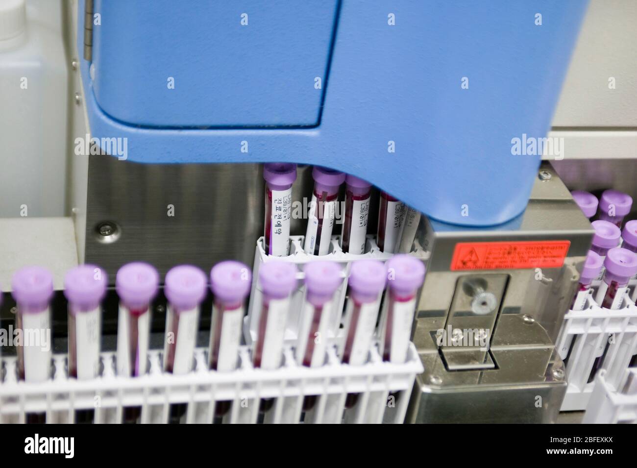 Blood samples processed through an automated blood analysis machine ...