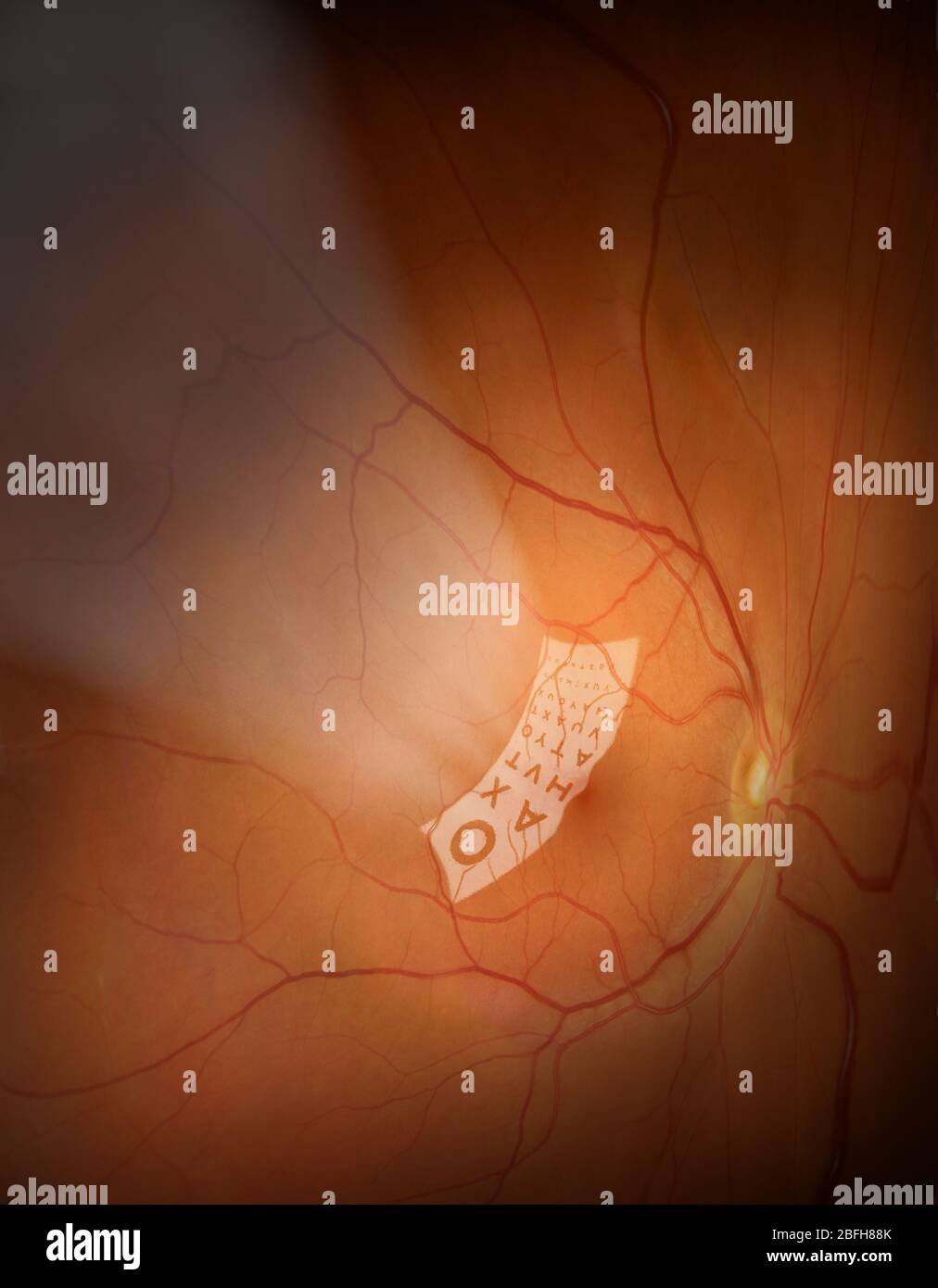 Eye test (impression Stock Photo - Alamy