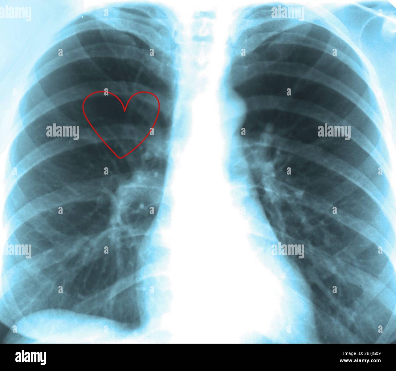 Human joint x ray gray background hi-res stock photography and images ...