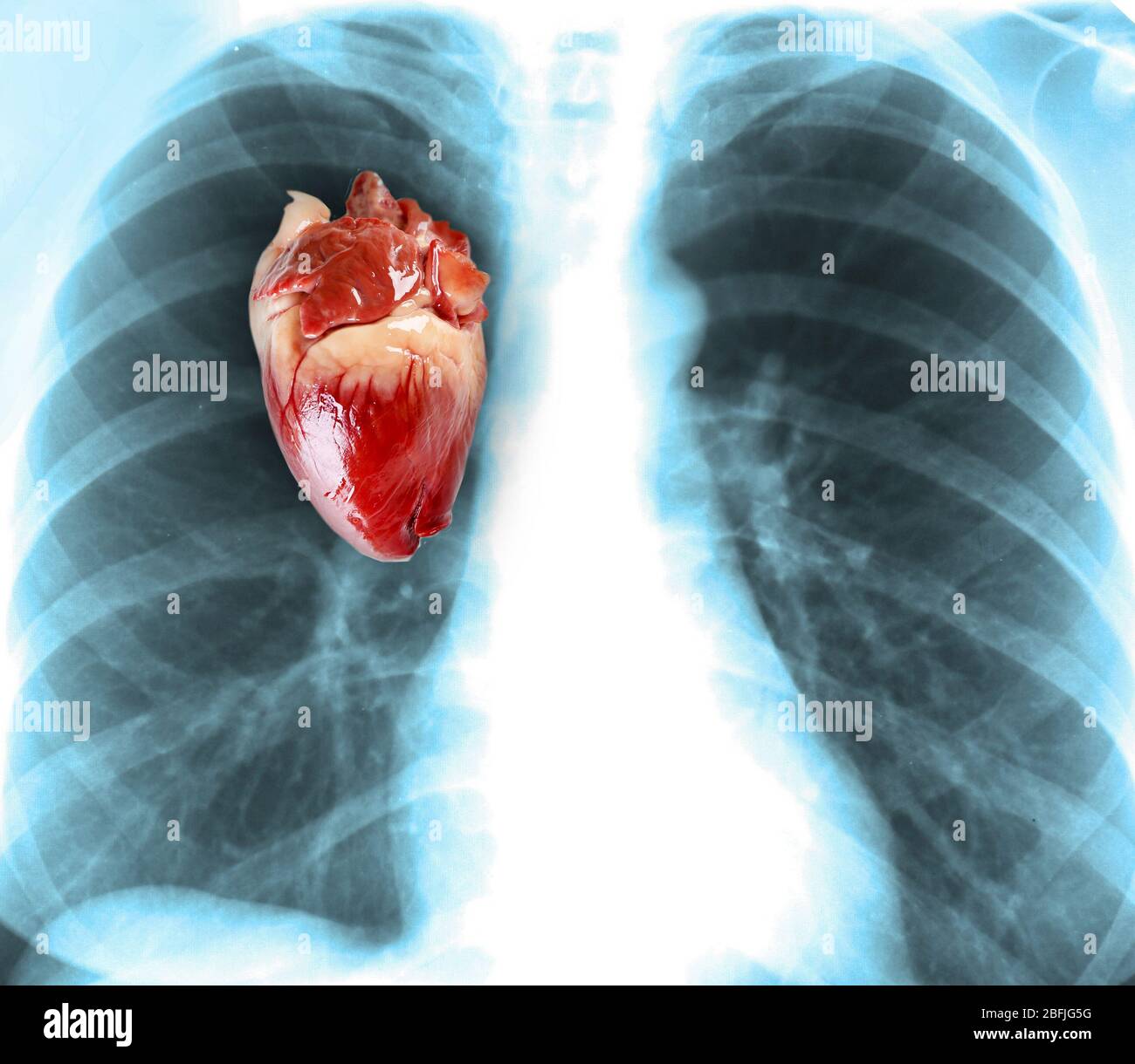 Human joint x ray gray background hi-res stock photography and images ...
