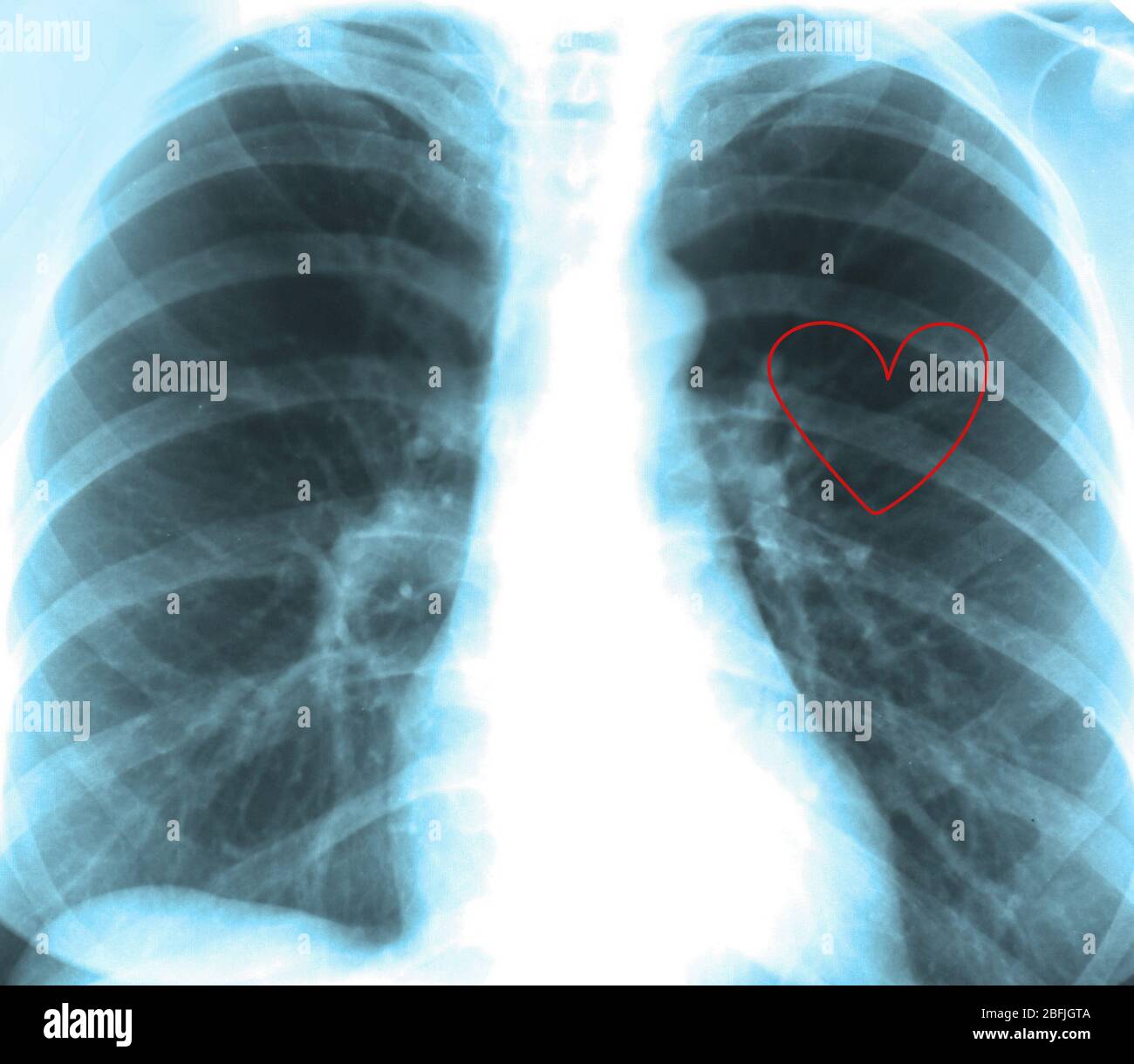 Human x-ray with heart, close-up Stock Photo - Alamy