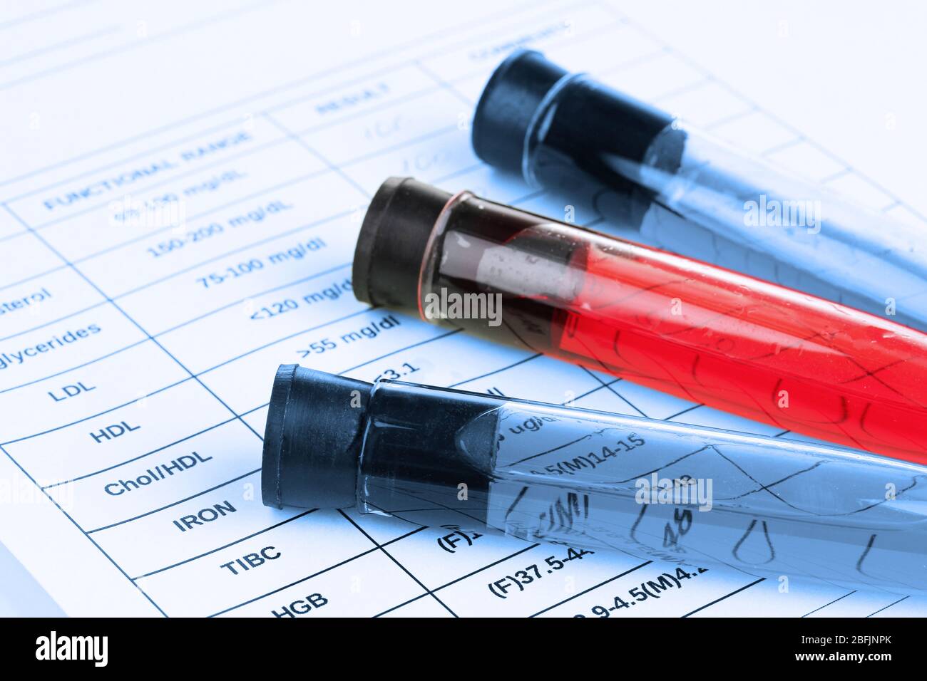Blood in test tubes and results close up Stock Photo - Alamy