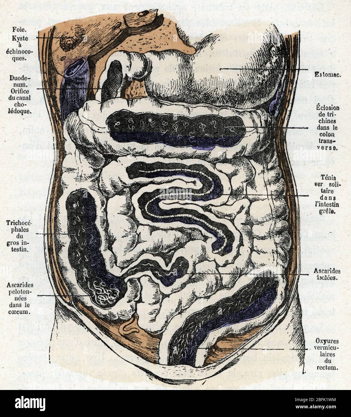 Intestinaux High Resolution Stock Photography and Images - Alamy