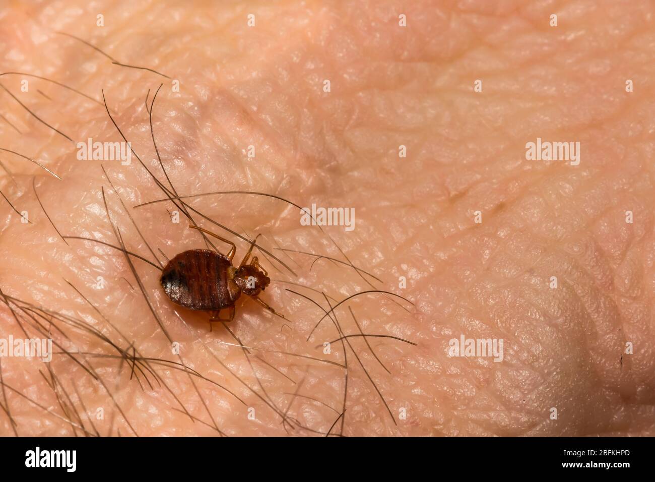 Common Bed Bug (Cimex lectularis Stock Photo - Alamy