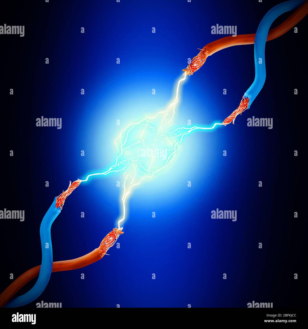 Electrocution Burn High Resolution Stock Photography and Images - Alamy