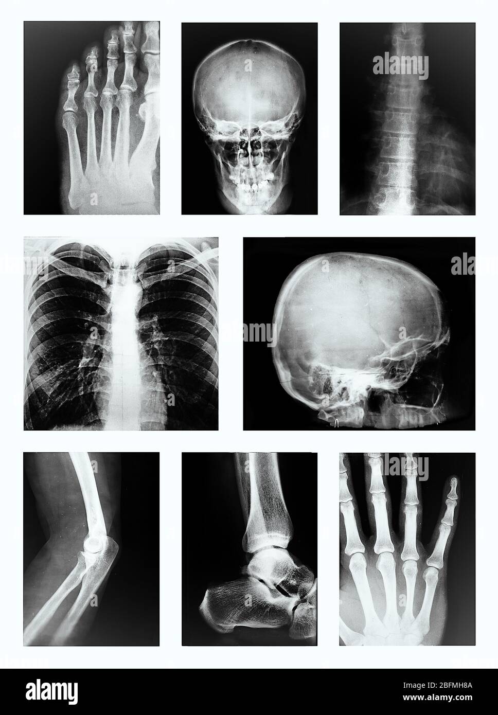 Collage of many X-rays Stock Photo - Alamy