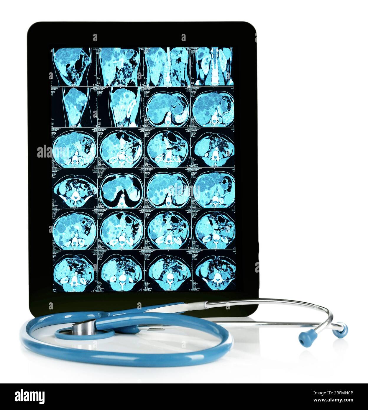Medical tablet with stethoscope isolated on white Stock Photo - Alamy