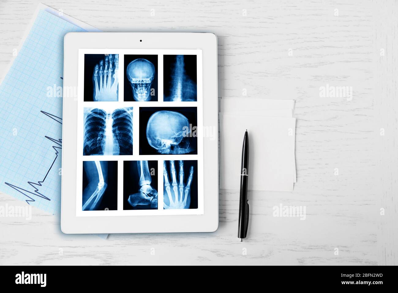Digital x rays on computer screen hi-res stock photography and images ...