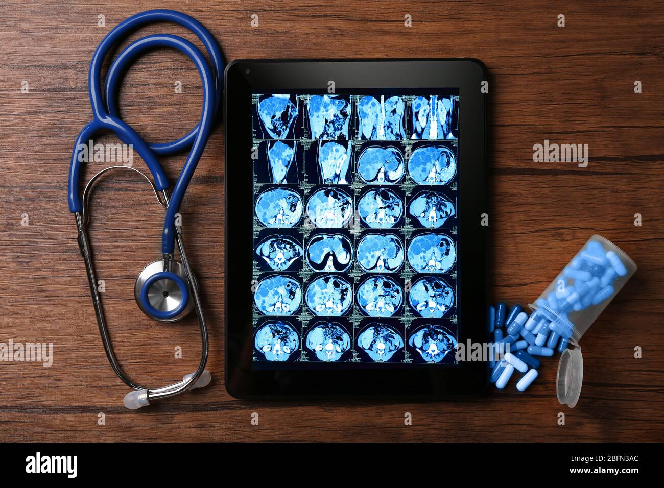 Tomography on the tablet screen with stethoscope on wooden background ...