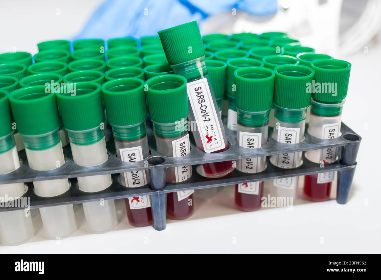 Coronavirus pandemic. Lab test tubes in rack. SARS-CoV-2 blood samples ...