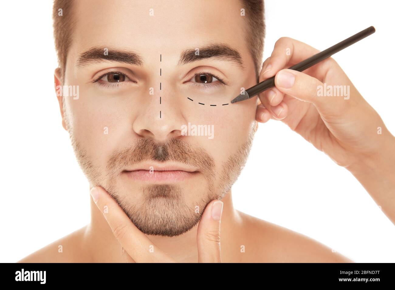 Surgeon drawing marks on male face against white background. Plastic ...