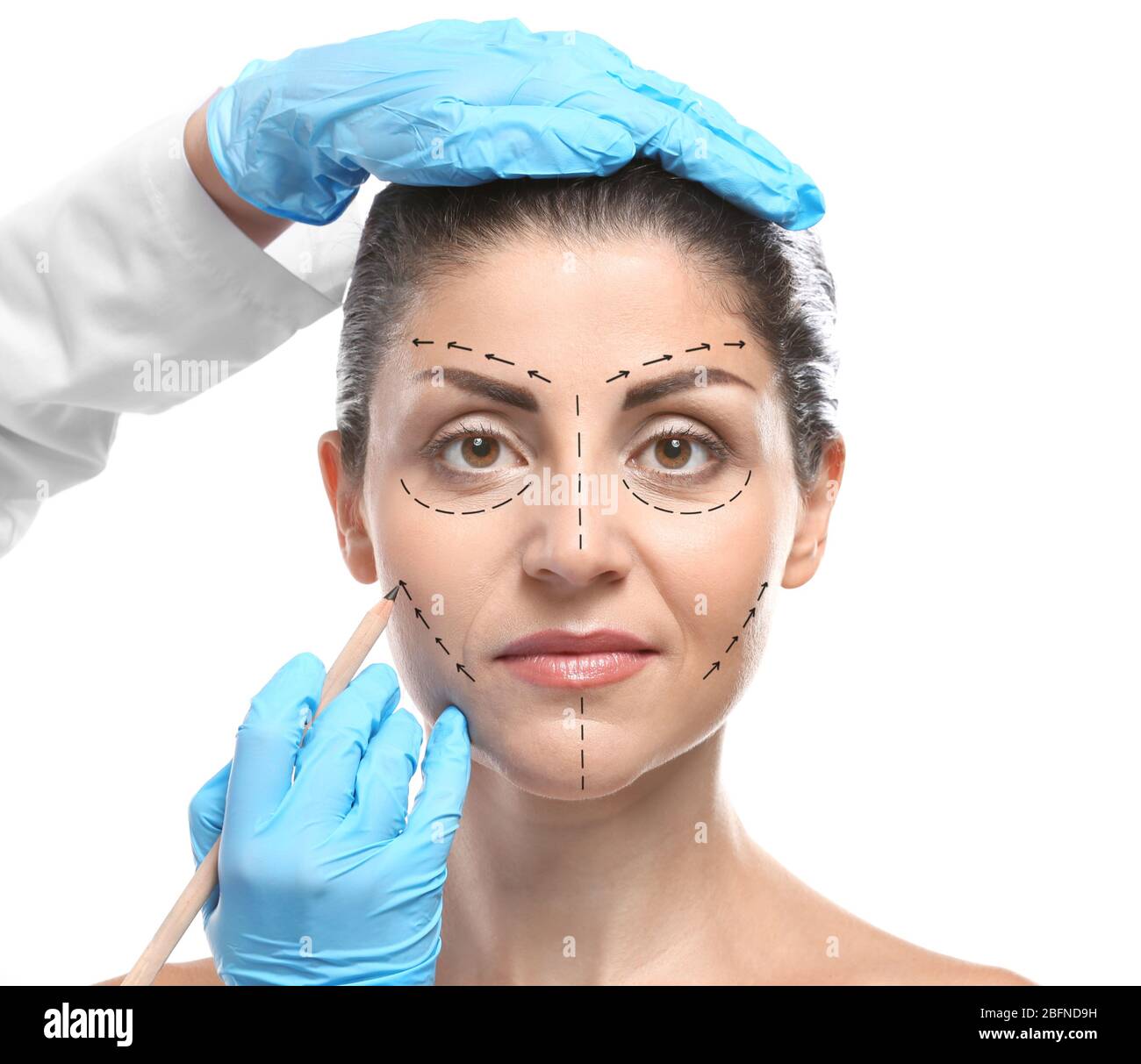 Surgeon drawing marks on female face against white background. Plastic ...