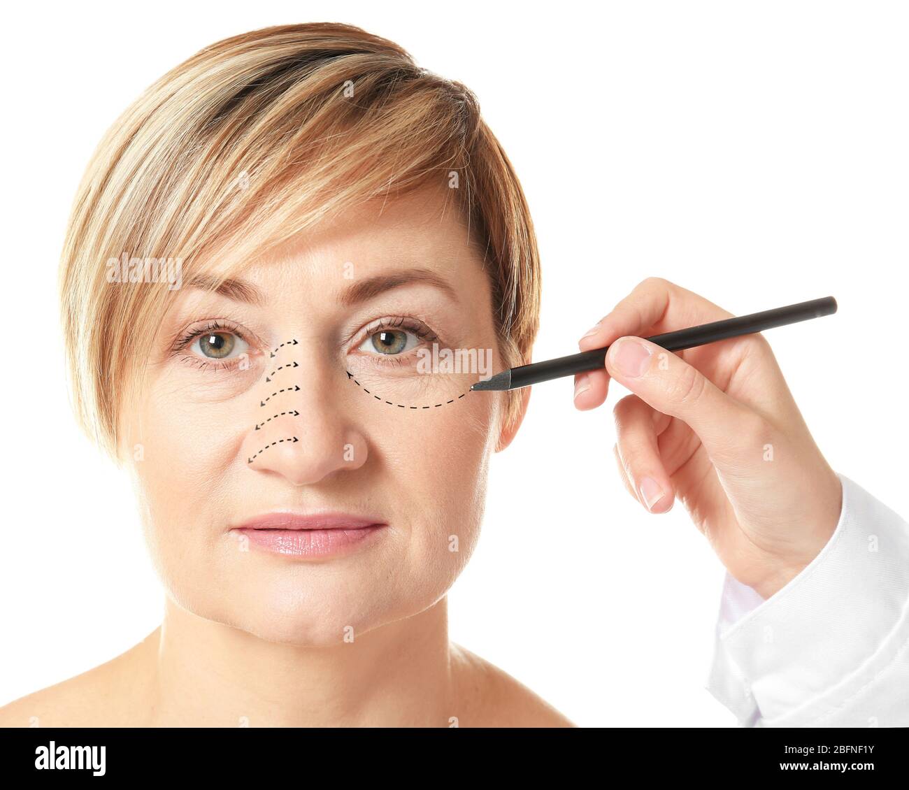 Surgeon drawing marks on female face against white background. Plastic ...