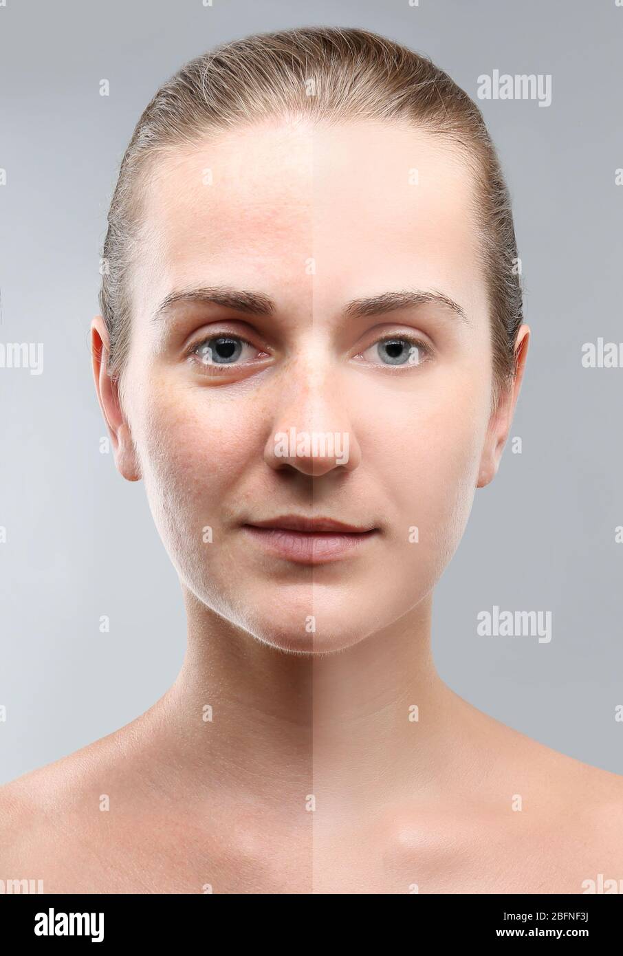 Woman face before and after cosmetic procedure. Plastic surgery concept ...