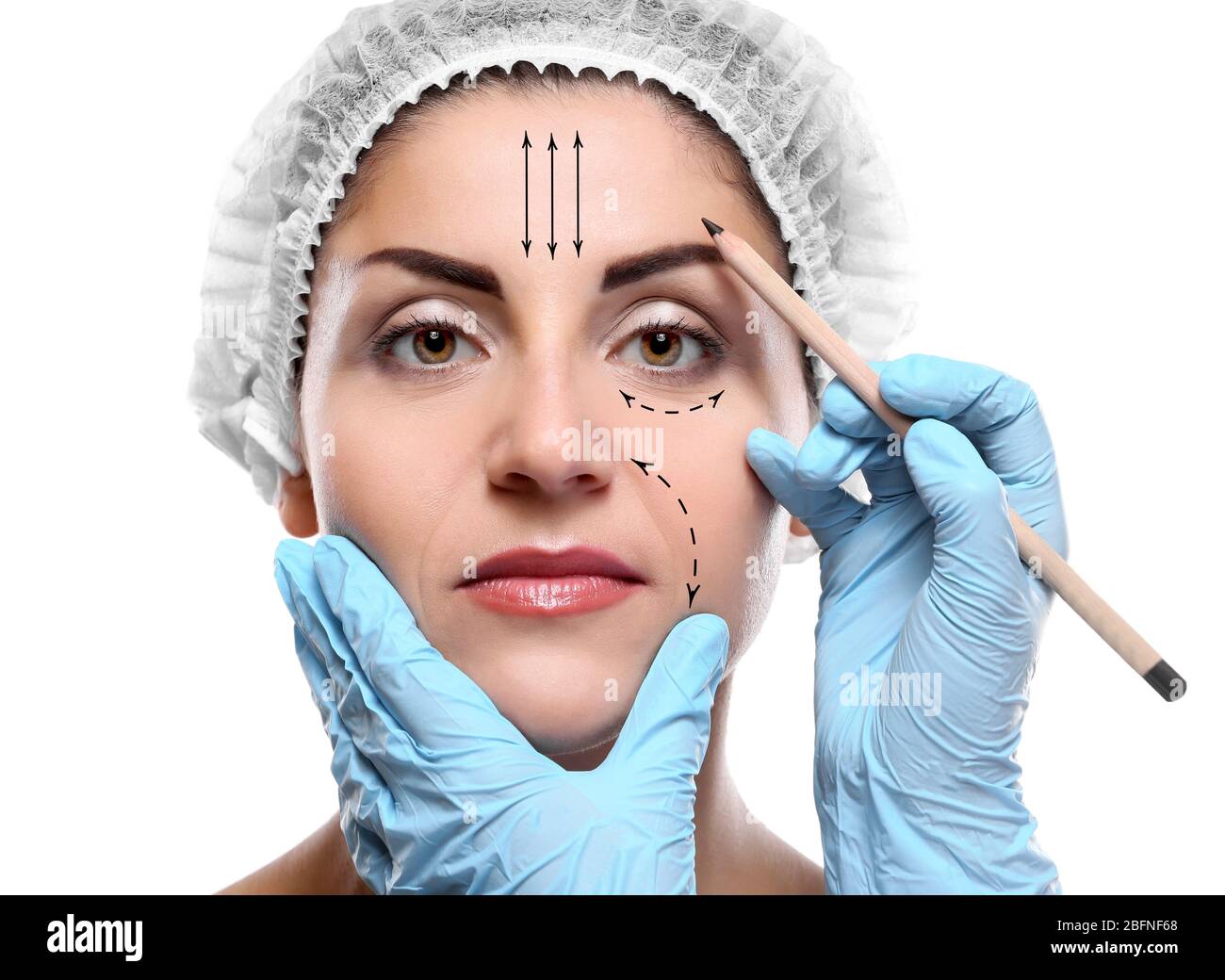 Plastic surgery concept. Doctor drawing marks on female face against ...