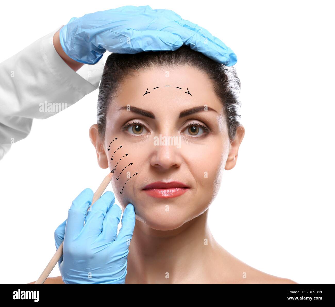 Plastic surgery concept. Doctor drawing marks on female face against ...