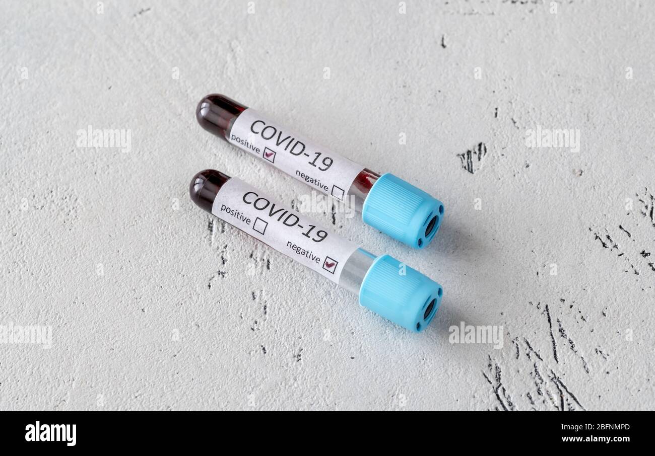 Test tube with blood sample for COVID-19 test Stock Photo - Alamy