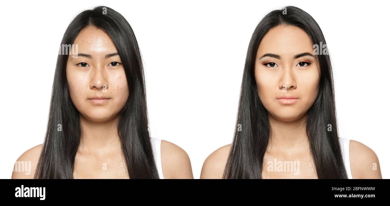Young woman before and after makeup application on white background ...