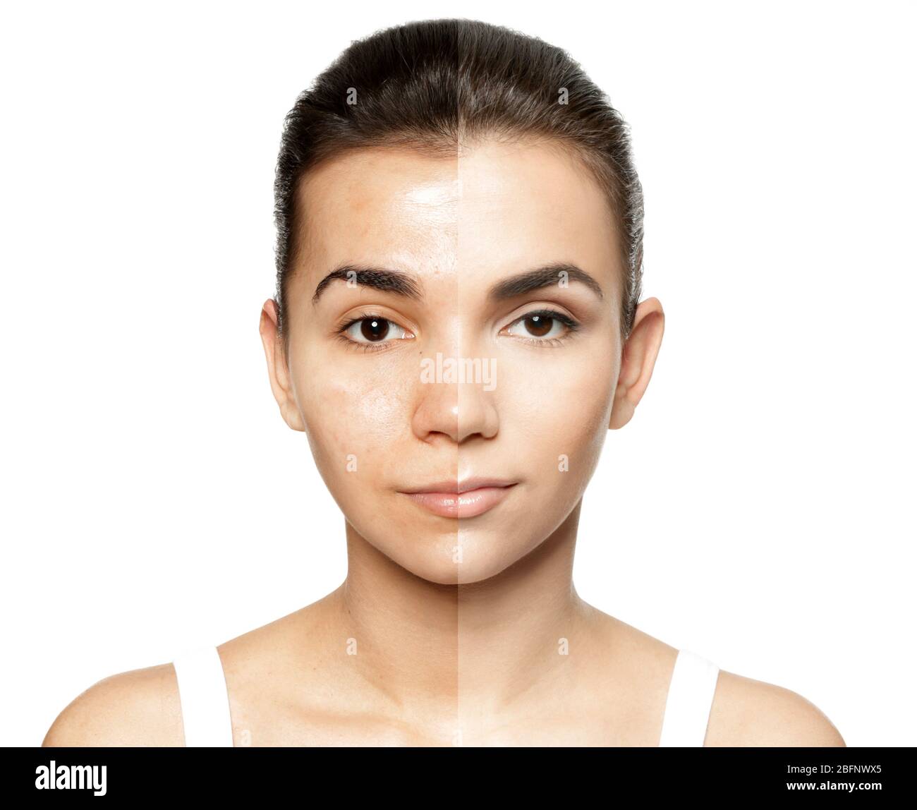 Young woman before and after makeup application on white background ...