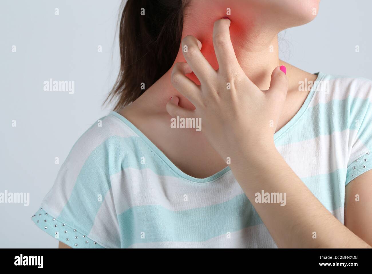Allergies and sore throat concept. Woman scratching neck, closeup Stock ...