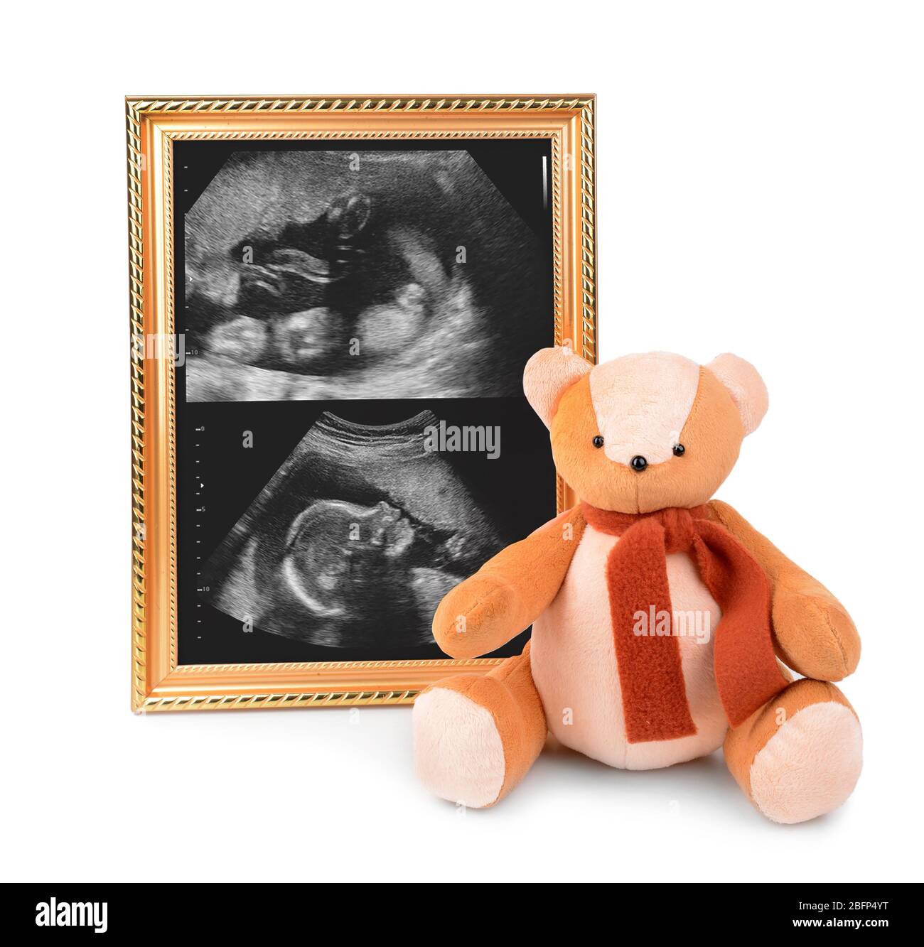 Frame with ultrasound scan of baby and bear toy isolated on white Stock ...