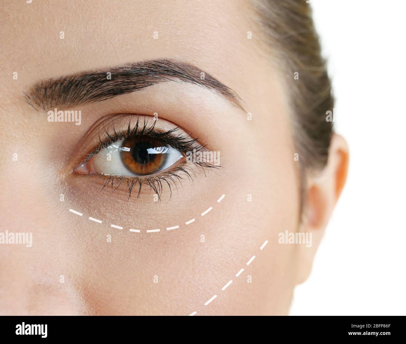 Plastic surgery concept. Portrait of beautiful woman on white ...