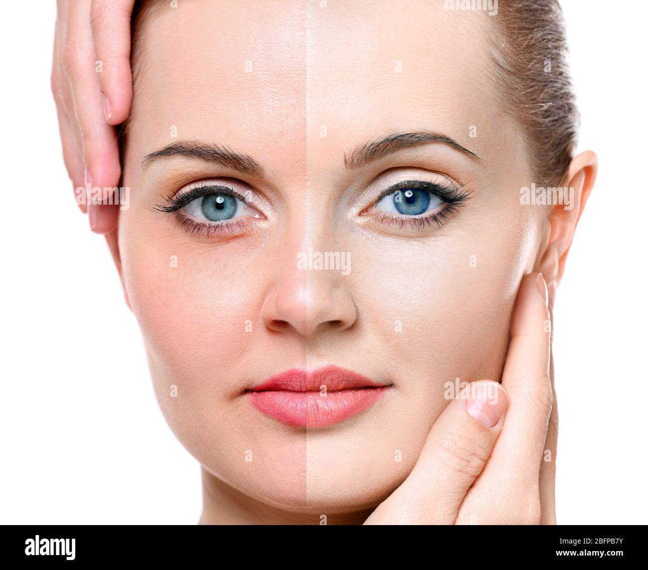 Woman face before and after cosmetic procedure. Plastic surgery concept ...