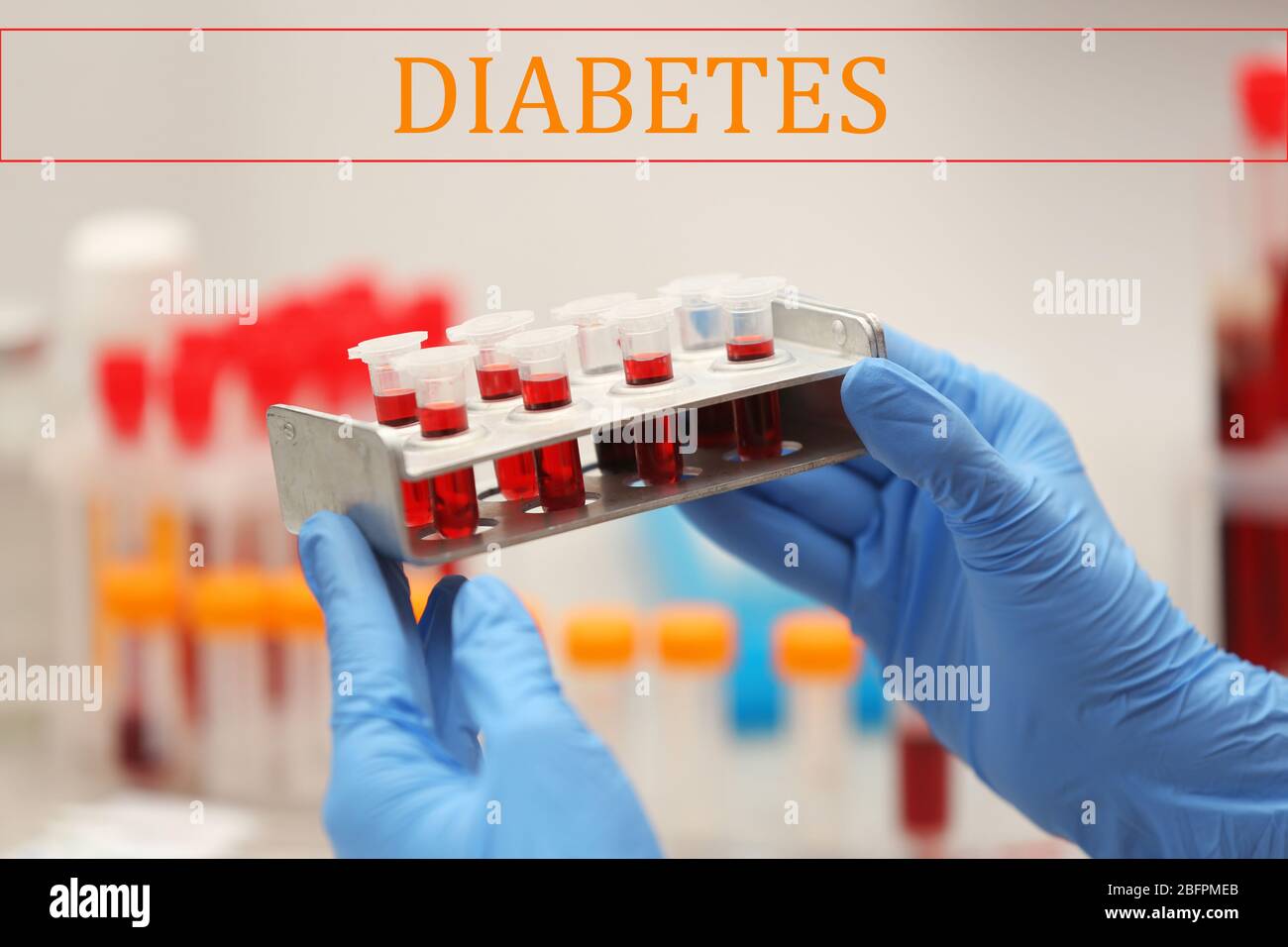 Diabetes concept. Scientist working with blood samples at laboratory ...
