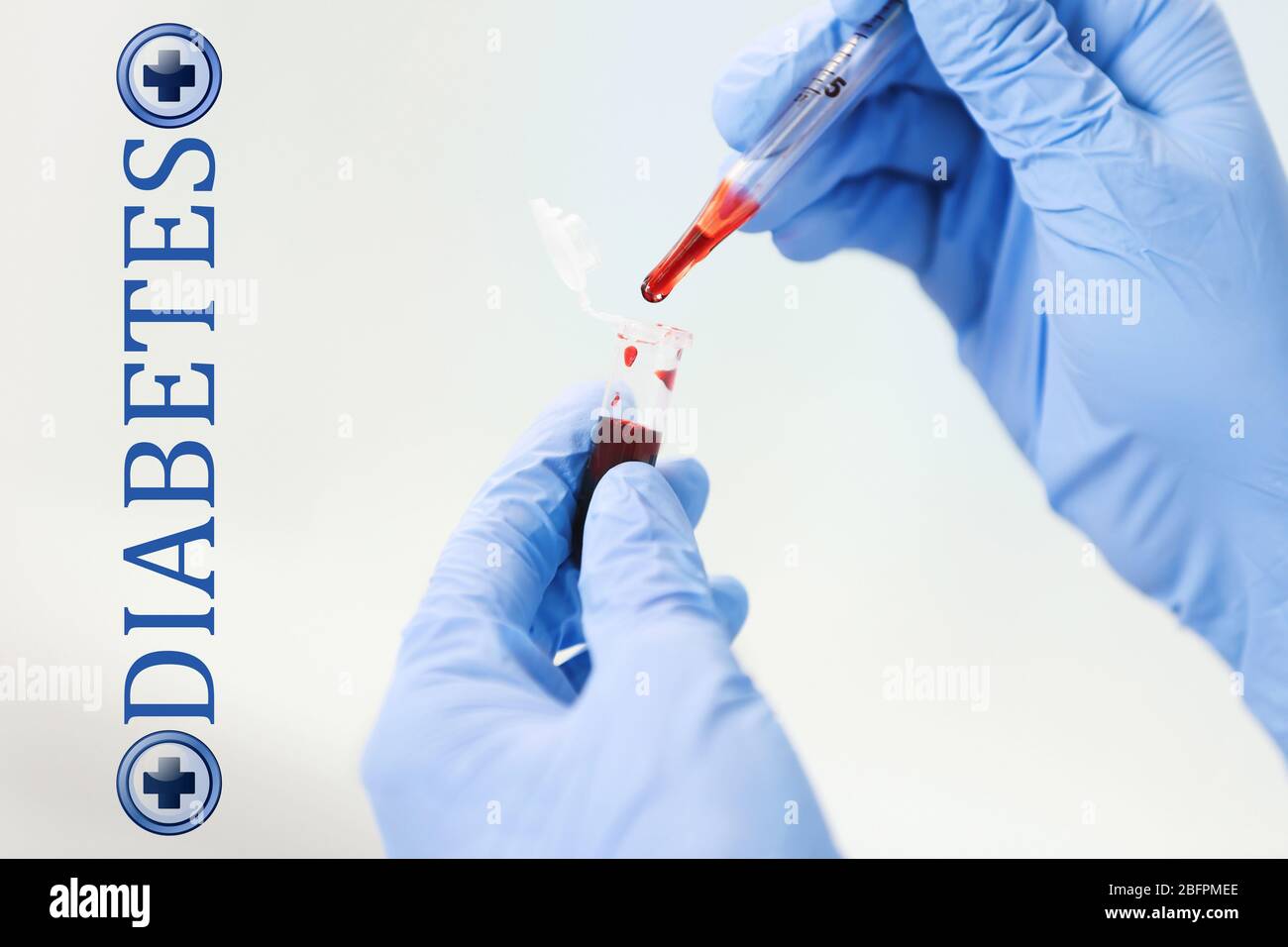 Diabetes concept. Scientist working with blood sample on light ...