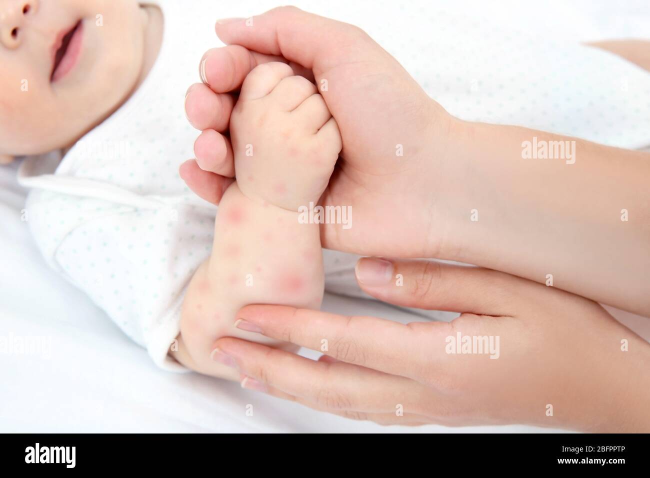 Child skin examination hi-res stock photography and images - Alamy