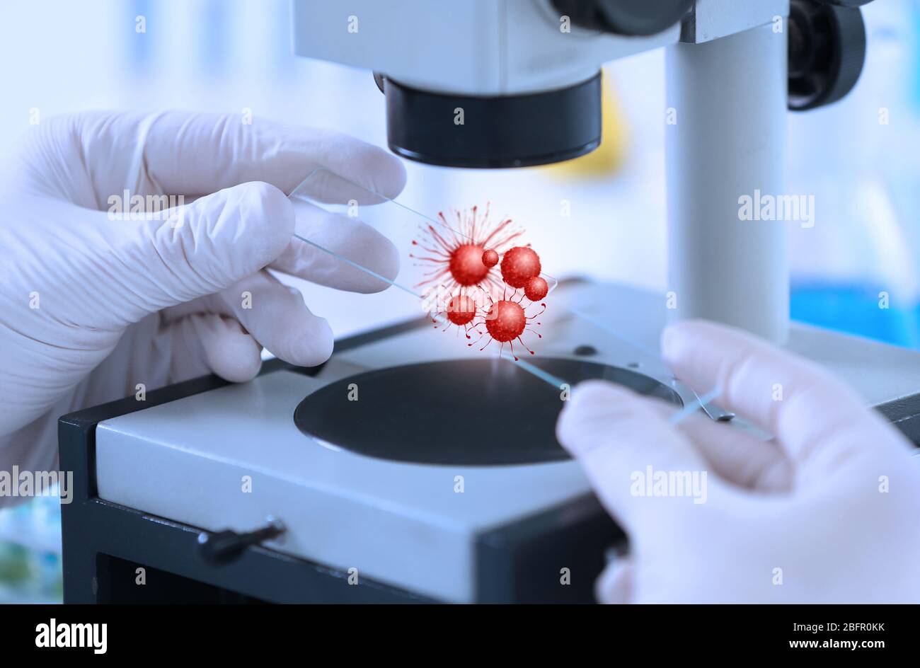 Scientist studying samples at laboratory. Concept of cancer research ...