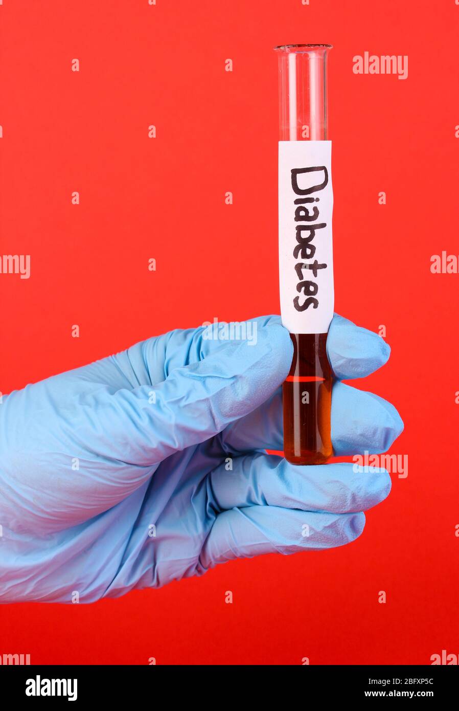 Test tube labeled Diabetes in hand on red background Stock Photo - Alamy