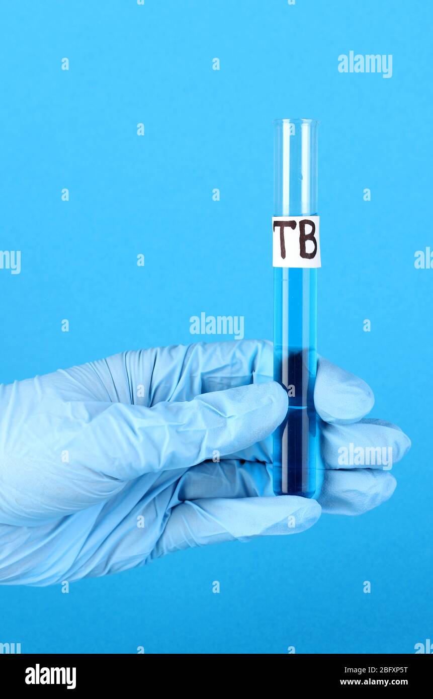 Test tube labeled Tuberculosis(TB) in hand on blue background Stock ...