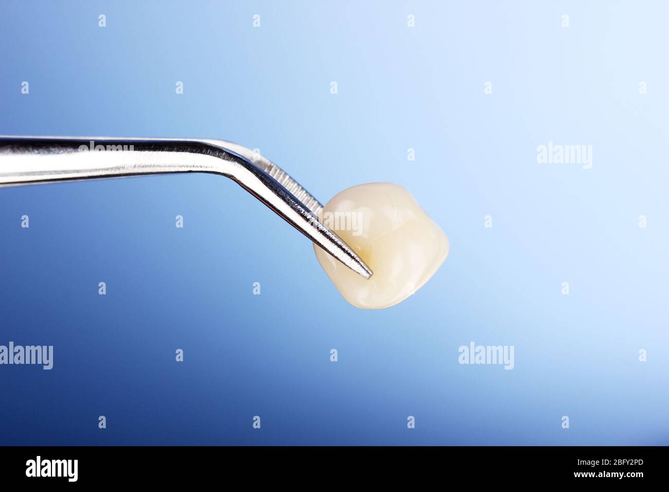 dental forceps with tooth Stock Photo - Alamy
