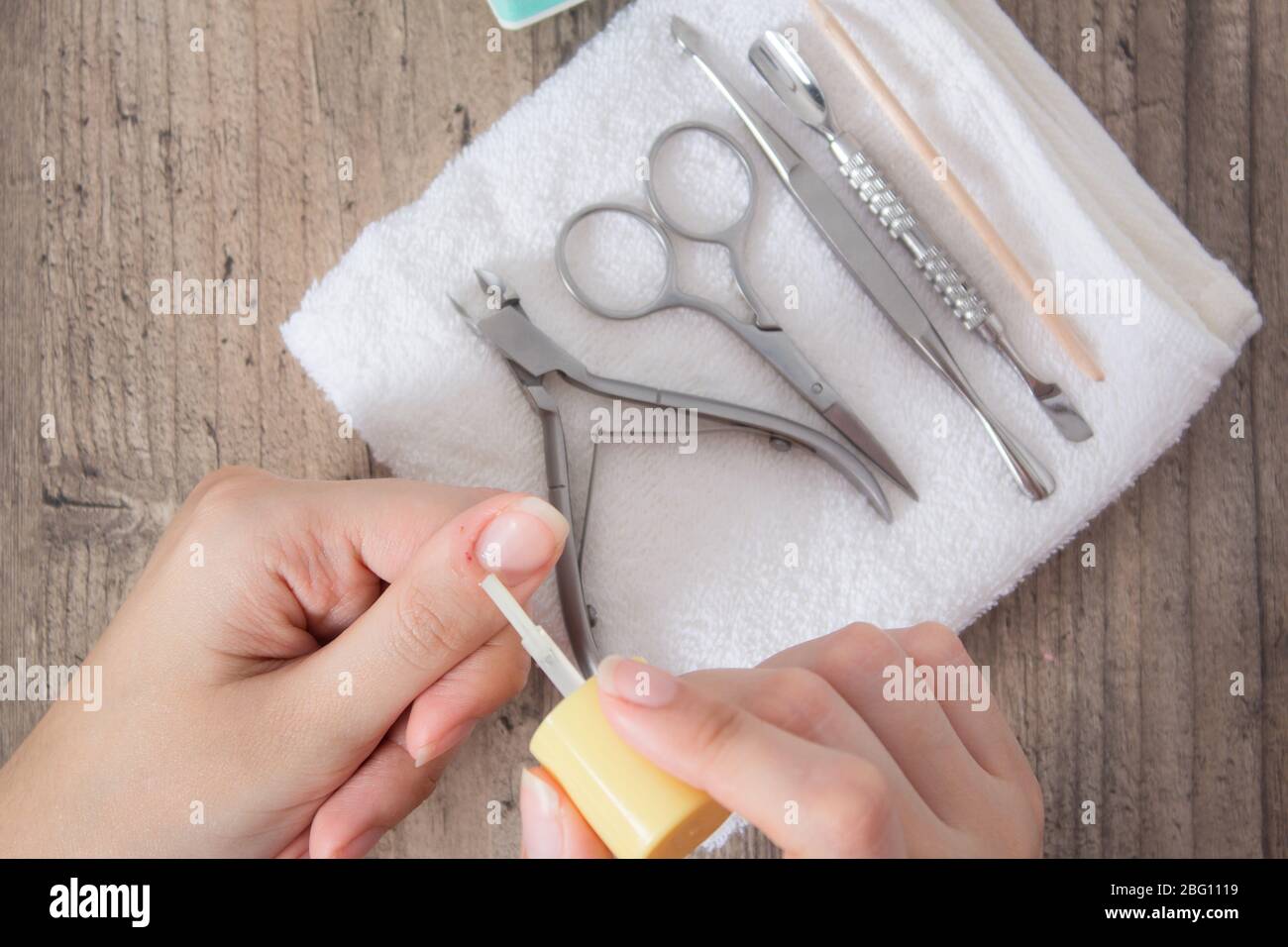 Cuticle wound hi-res stock photography and images - Alamy