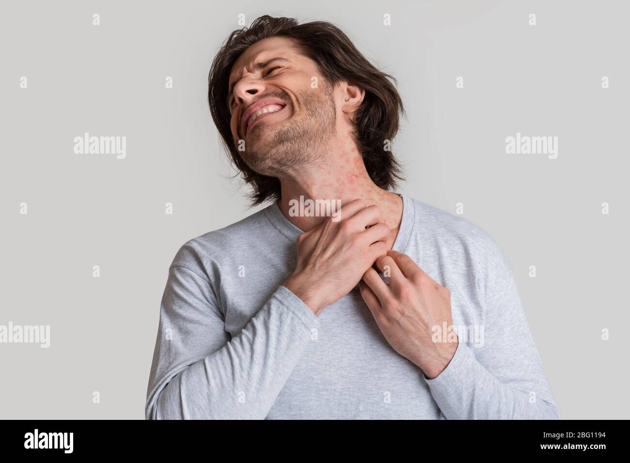 Skin irritation hi-res stock photography and images - Alamy