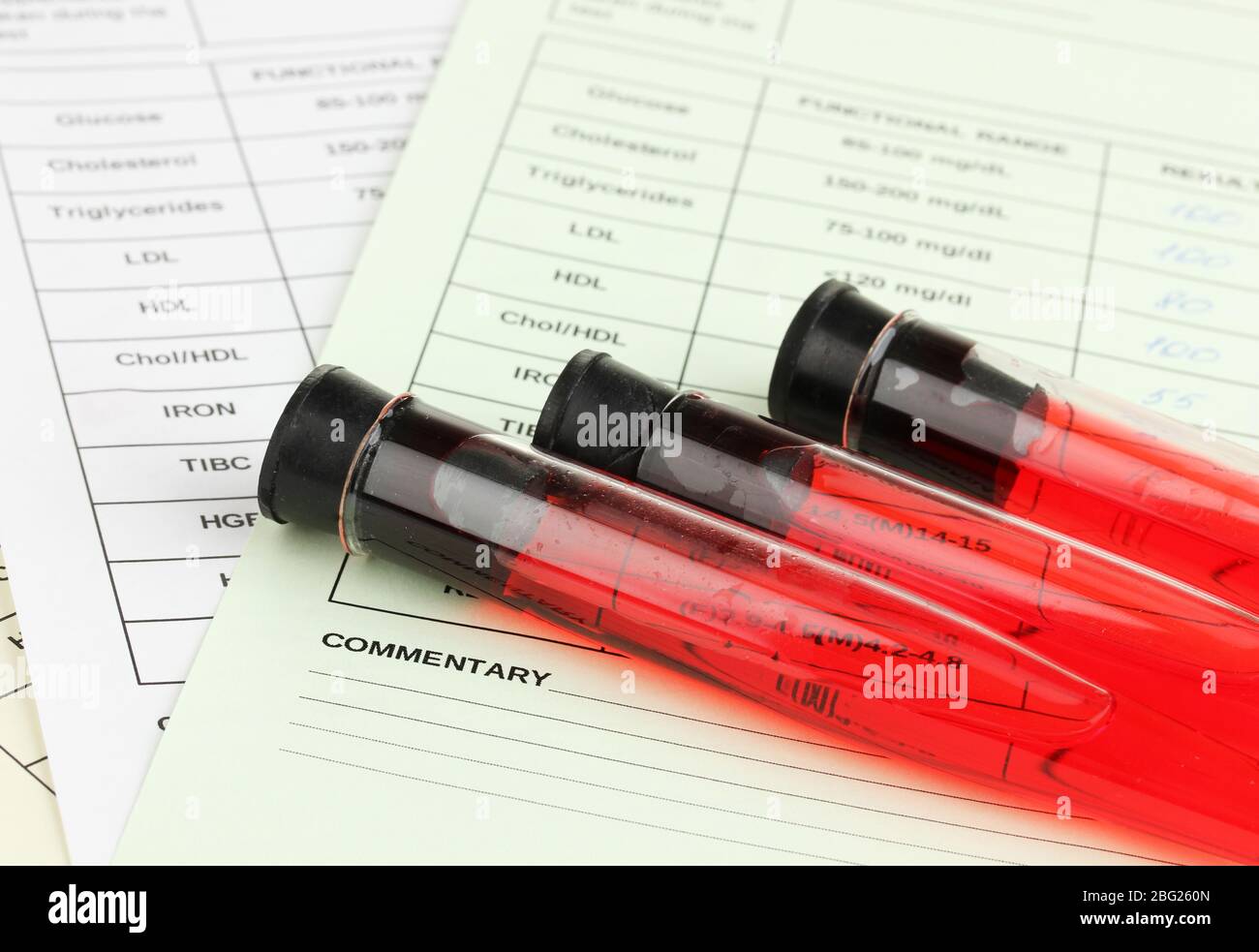 Blood in test tubes and results close up Stock Photo - Alamy