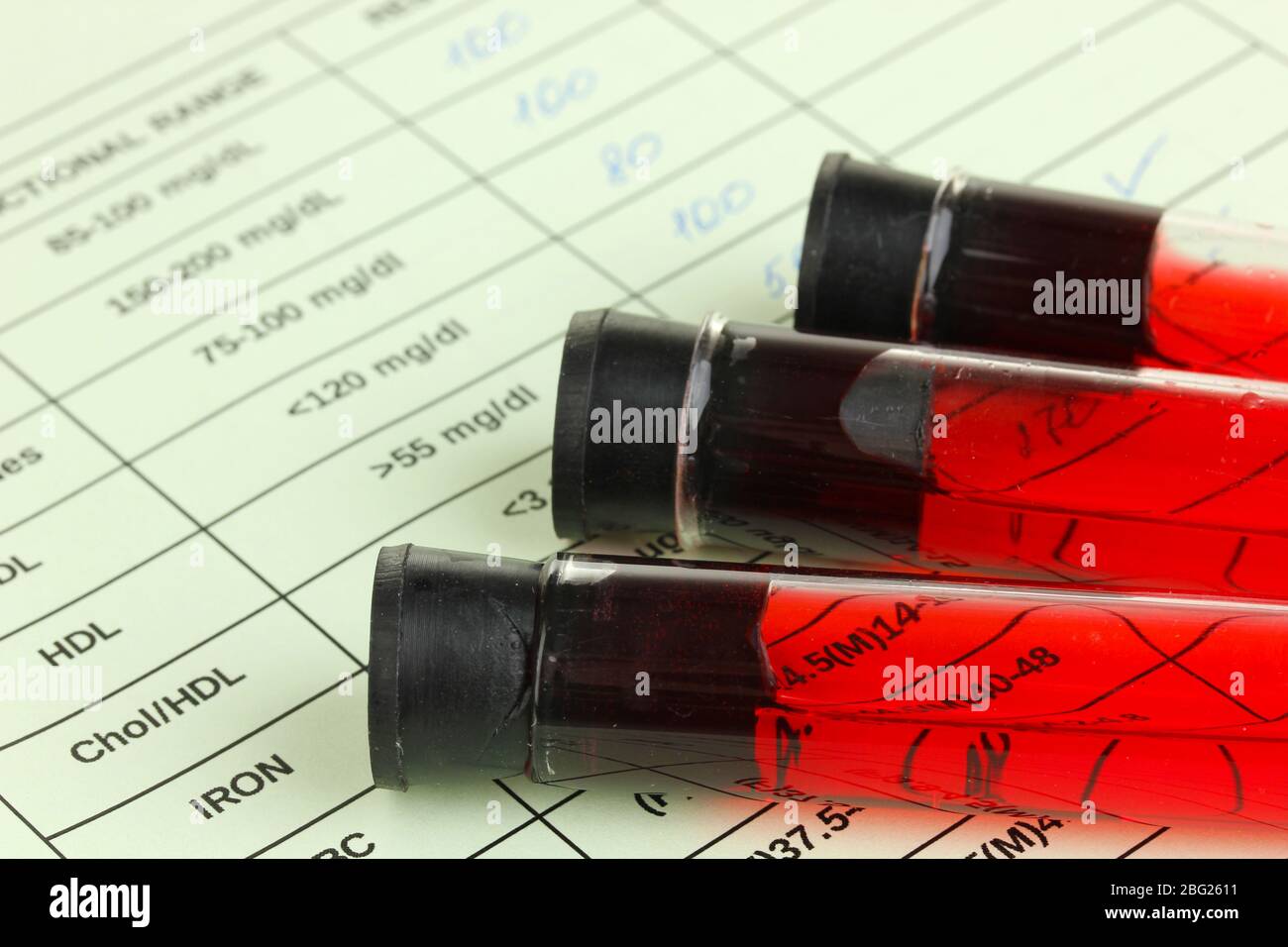 Sample storage test tubes in hi-res stock photography and images - Alamy