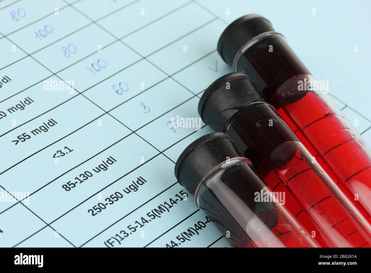 Blood in test tubes and results close up Stock Photo - Alamy