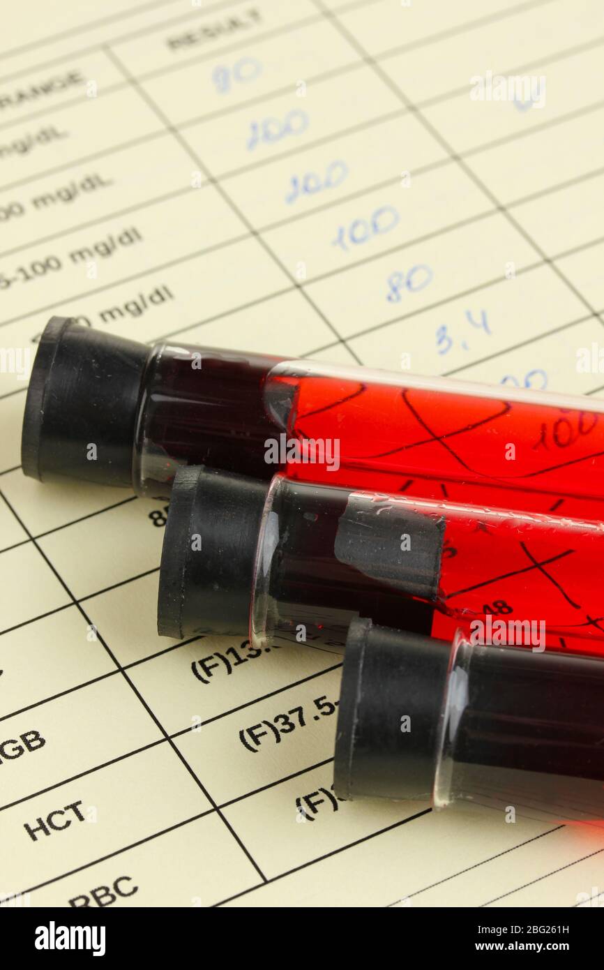 Blood in test tubes and results close up Stock Photo - Alamy