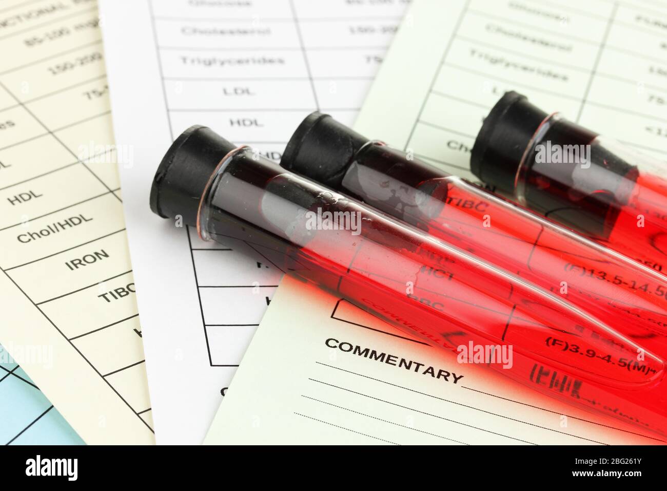 Blood in test tubes and results close up Stock Photo - Alamy