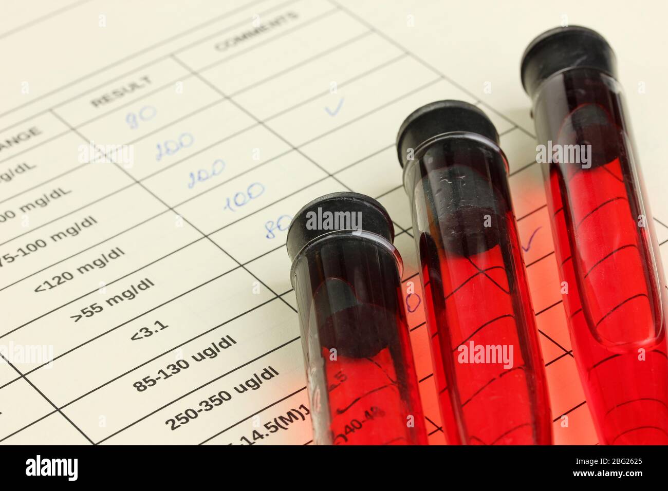 Sample storage test tubes in hi-res stock photography and images - Alamy