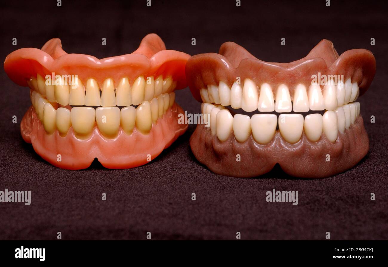 Two sets of full dentures. Dentures or false teeth are made from an ...