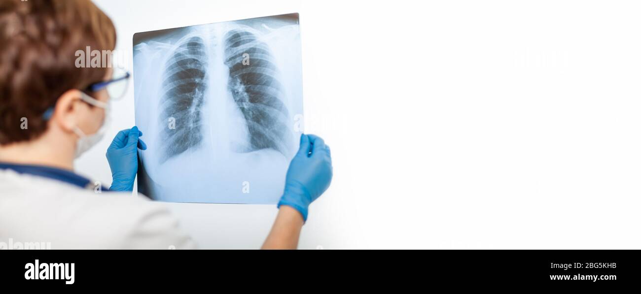 A female doctor examines an X-ray of a patient s lung infected with ...