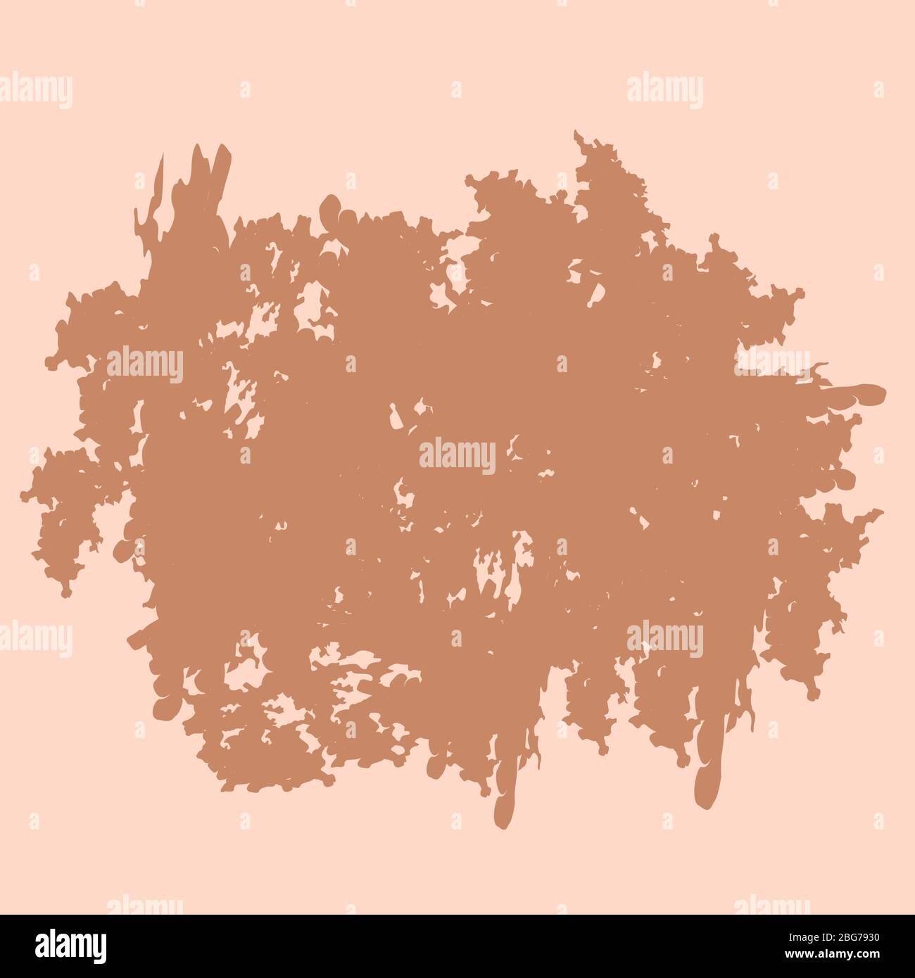 Pigmentation on the skin background. A pigmented spot on the skin of ...