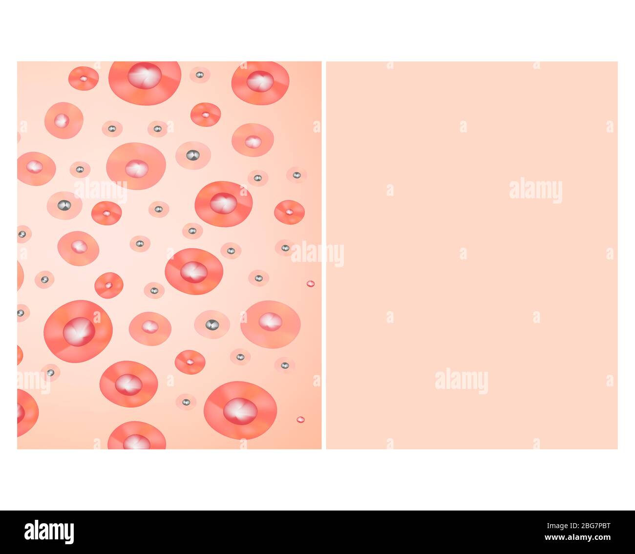 Texture, inflamed pimples and acne. Before After acne cysts. Skin ...